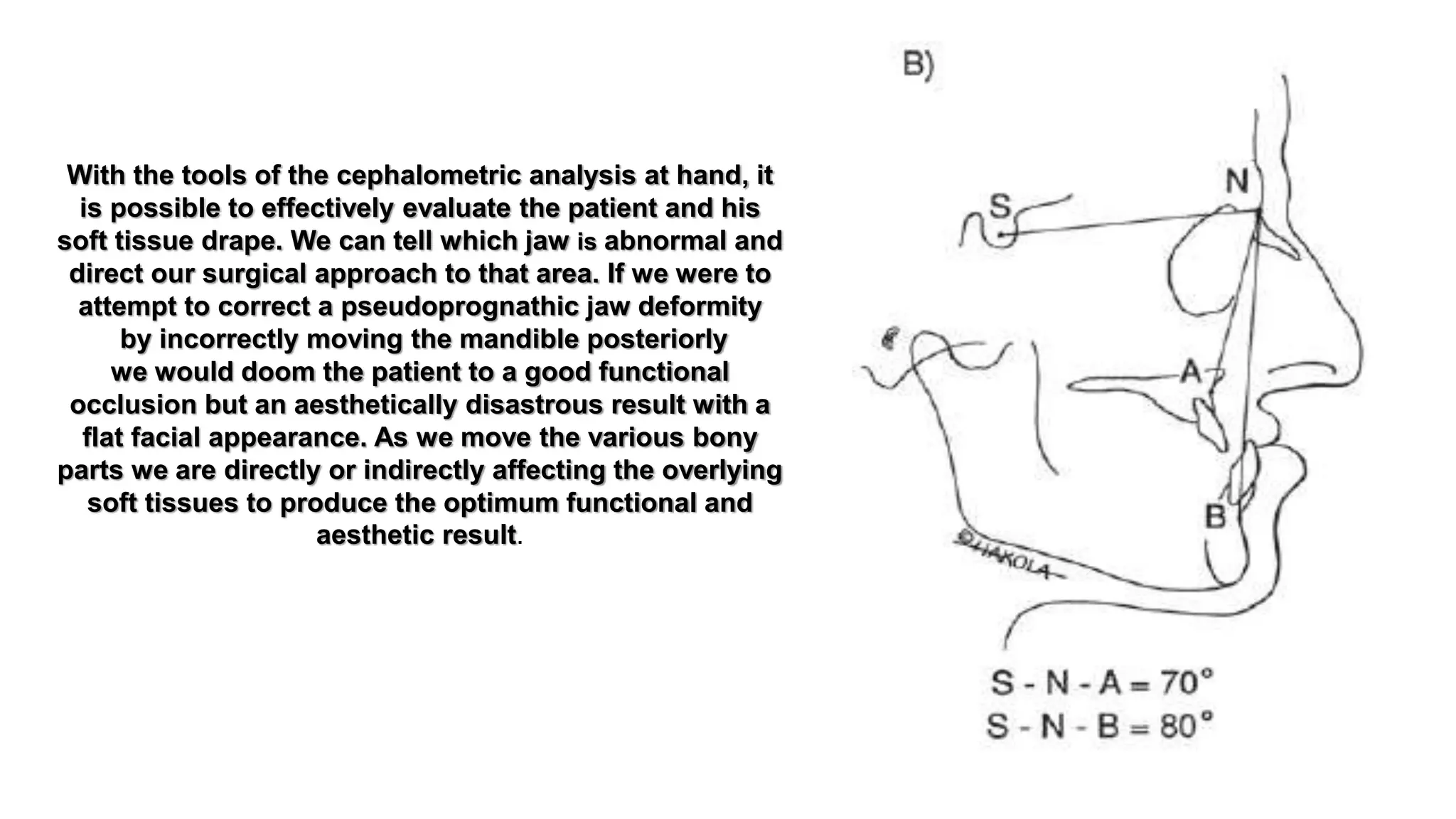 Cephalometric for orthognathic surgery part 1 | PPTX