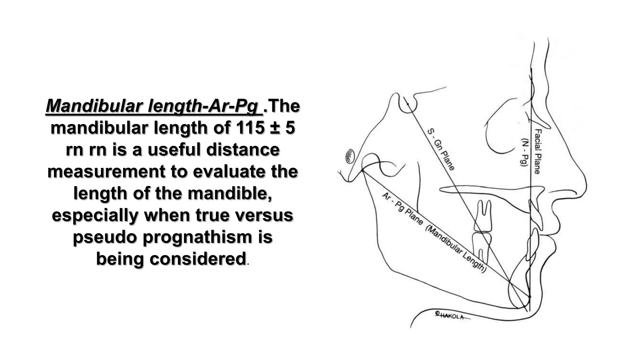Cephalometric for orthognathic surgery part 1 | PPTX
