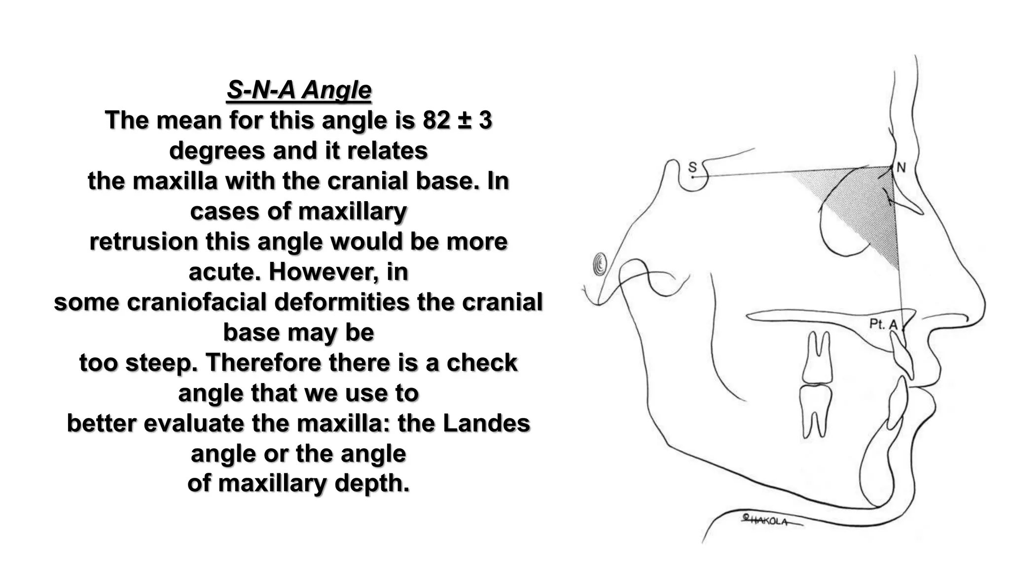 Cephalometric for orthognathic surgery part 1 | PPTX