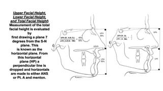 Cephalometric for orthognathic surgery part 1 | PPTX