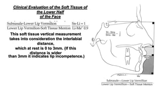 Cephalometric for orthognathic surgery part 1 | PPTX