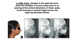 Cephalometric for orthognathic surgery part 1 | PPTX