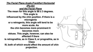 Cephalometric for orthognathic surgery part 1 | PPTX