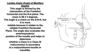 Cephalometric for orthognathic surgery part 1 | PPTX