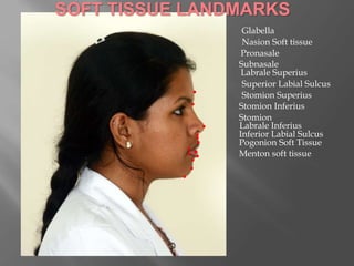 Cephalometric landmarks | PPTX