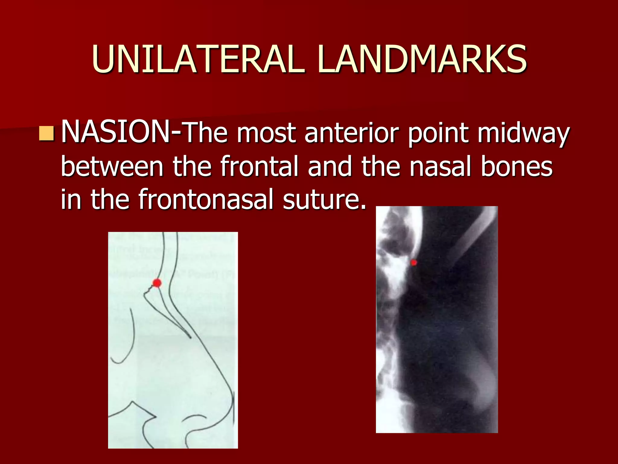 Cephalometric landmarks | PPT