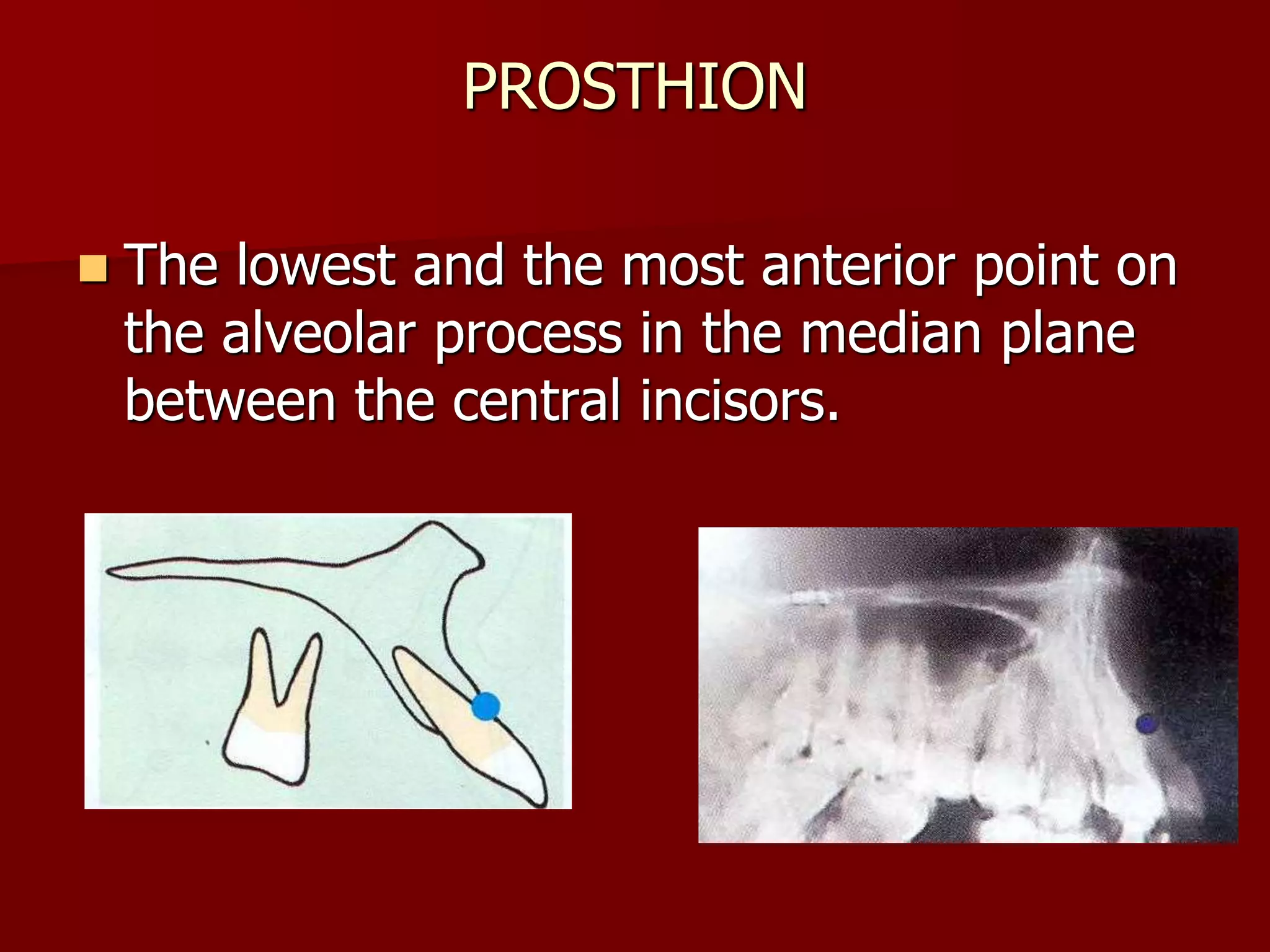 Cephalometric landmarks | PPT
