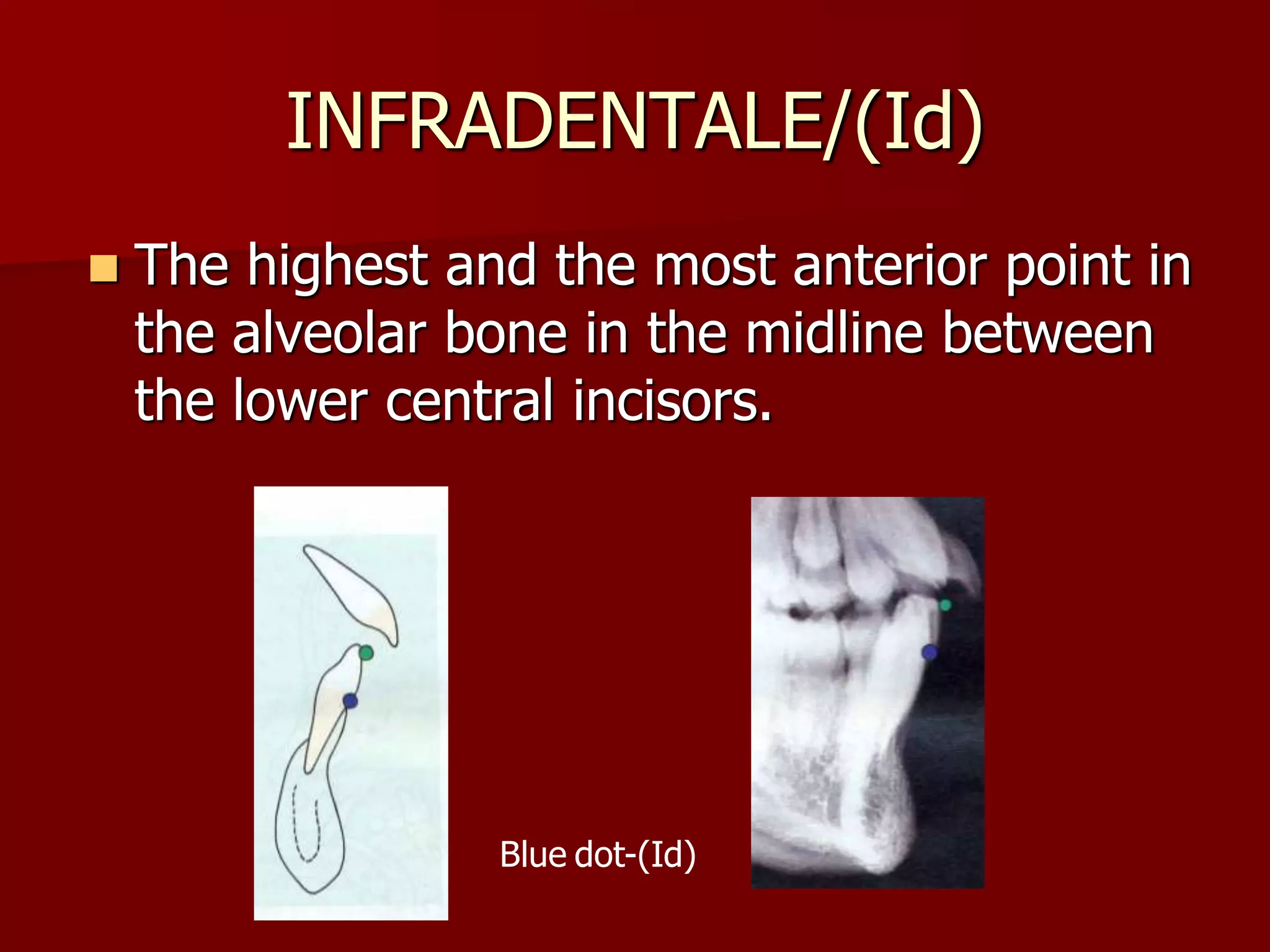 Cephalometric landmarks | PPT