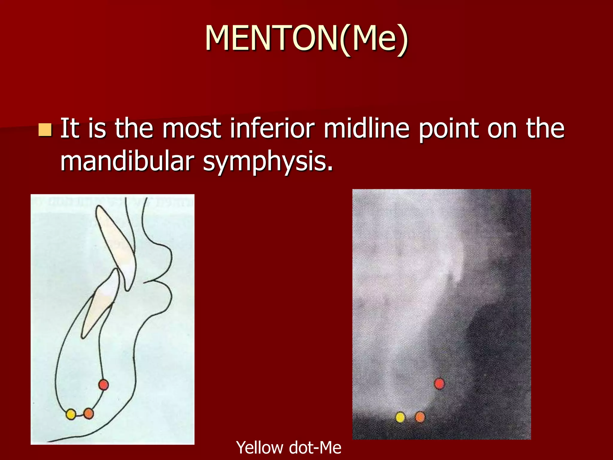 Cephalometric landmarks | PPT