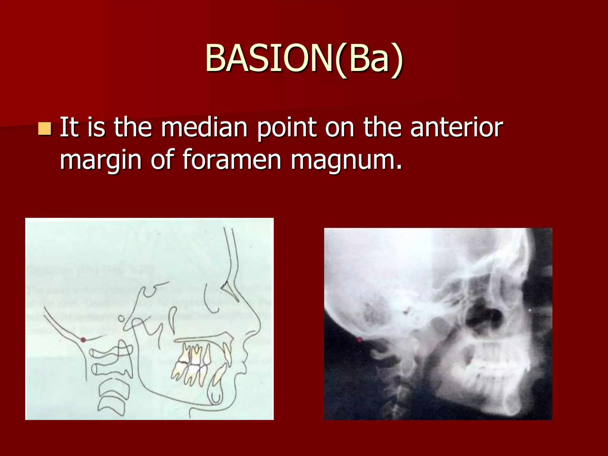 Cephalometric landmarks | PPT