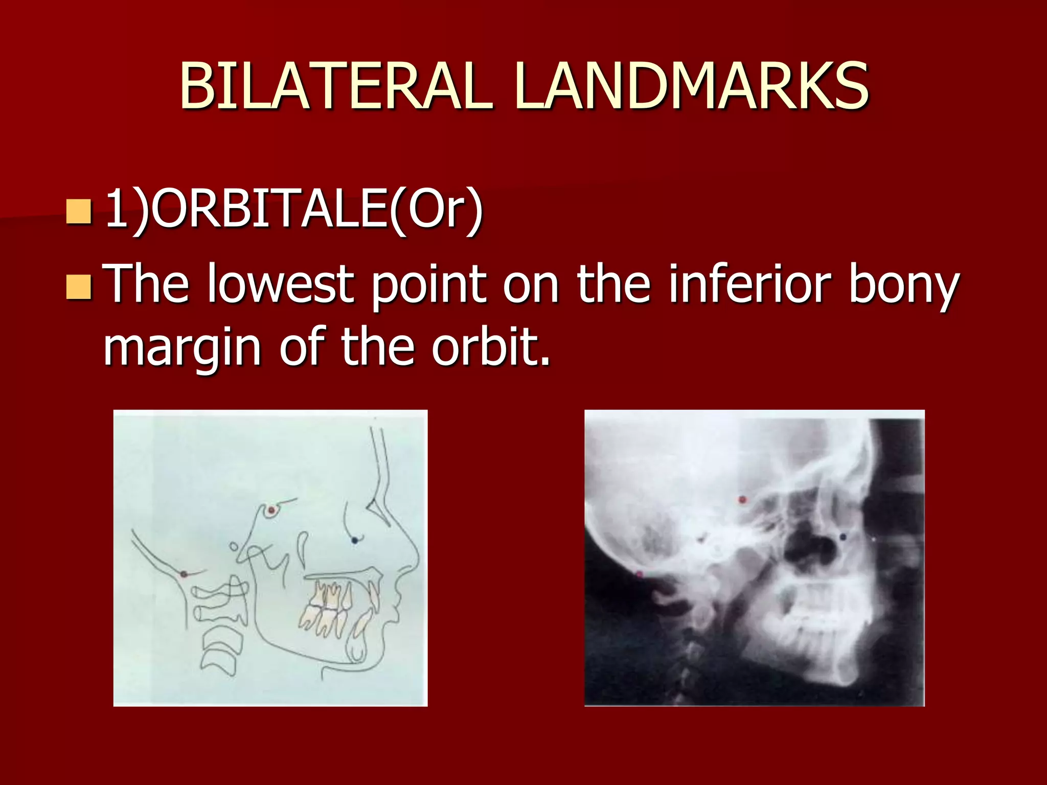 Cephalometric landmarks | PPT