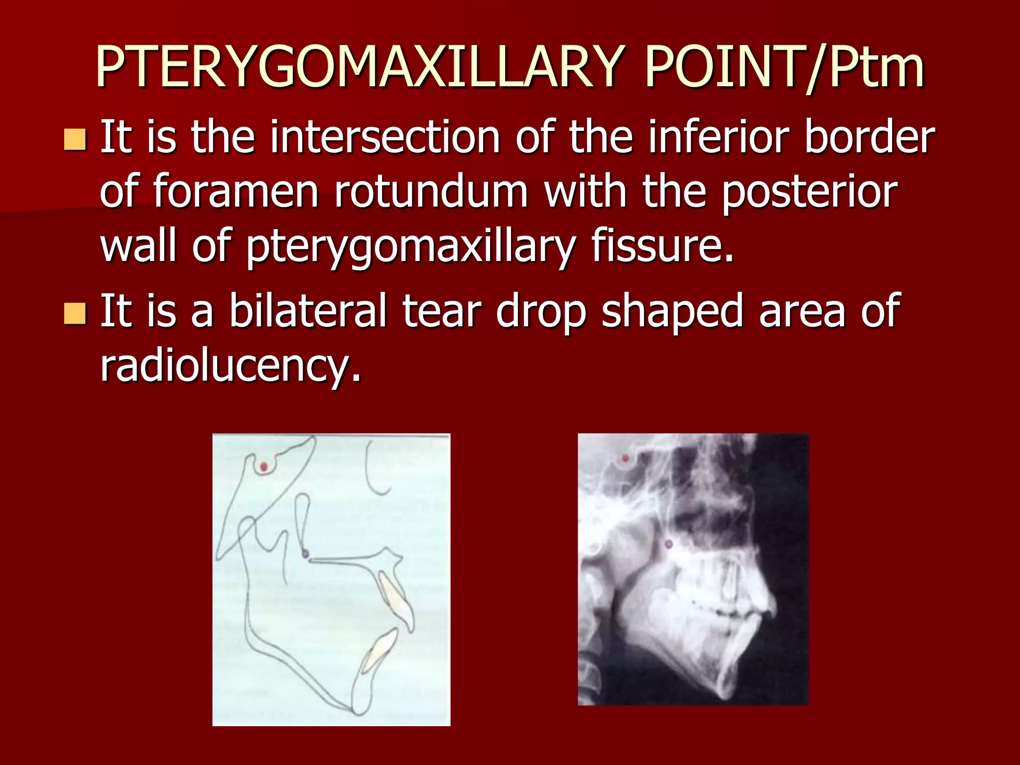 Cephalometric landmarks | PPT