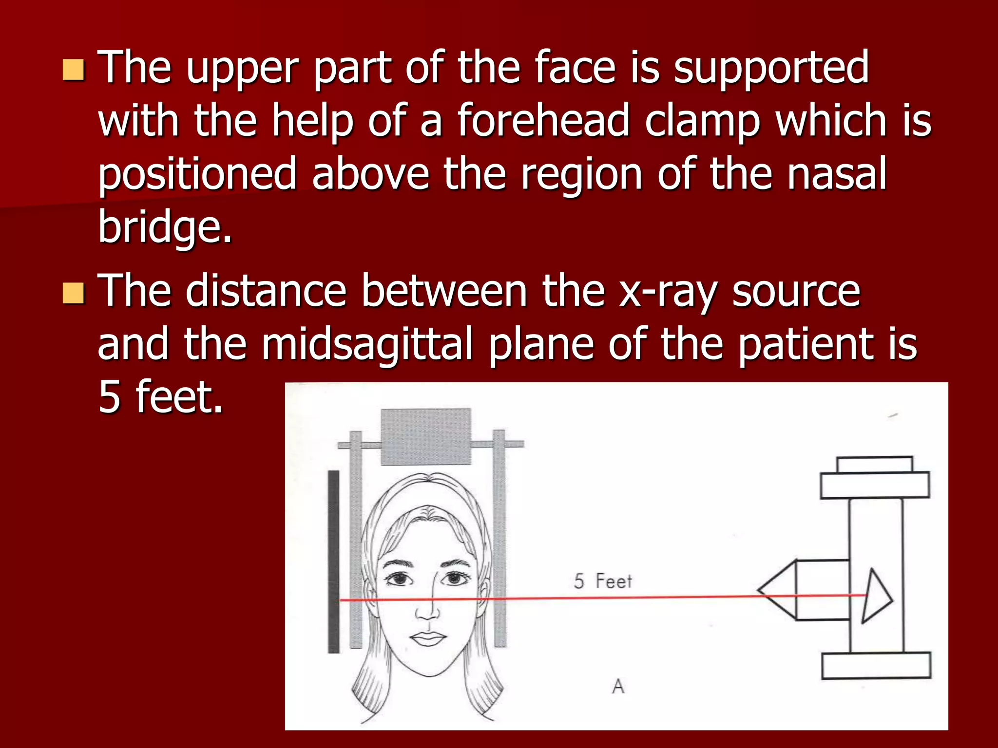 Cephalometric landmarks | PPT