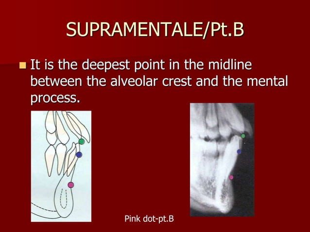 Cephalometric landmarks | PPT | Dental Health | Diseases and Conditions