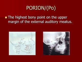 Cephalometric landmarks | PPT