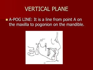Cephalometric landmarks | PPT