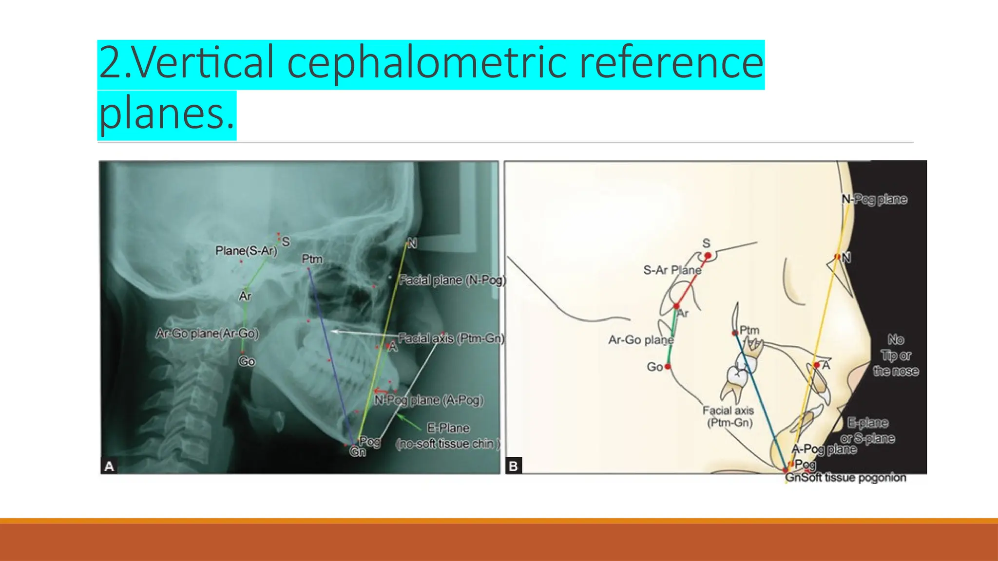 Cephalometric Radiograph : Orthodontic applications.pptx