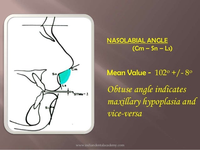 Cephalometrics /certified fixed orthodontic courses by Indian dental