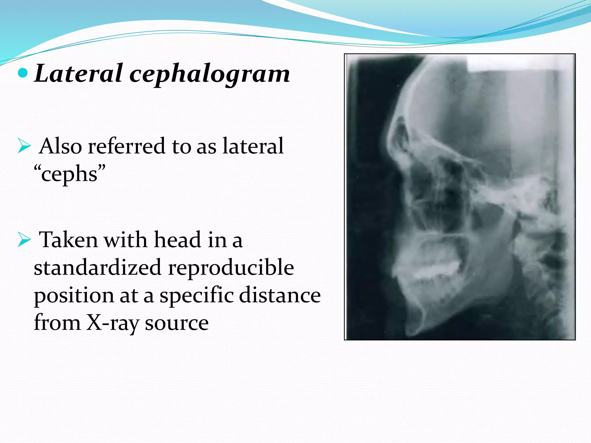 Cephalometrics (hard and soft tissue ) - in detail | PPTX