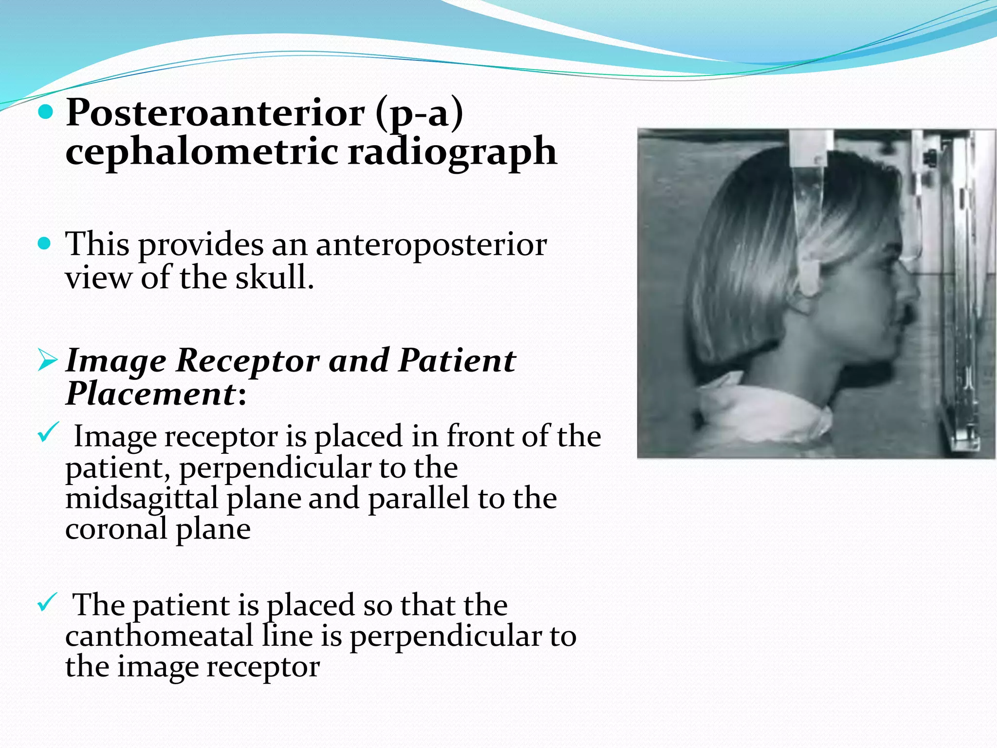 Cephalometrics (hard and soft tissue ) - in detail | PPTX