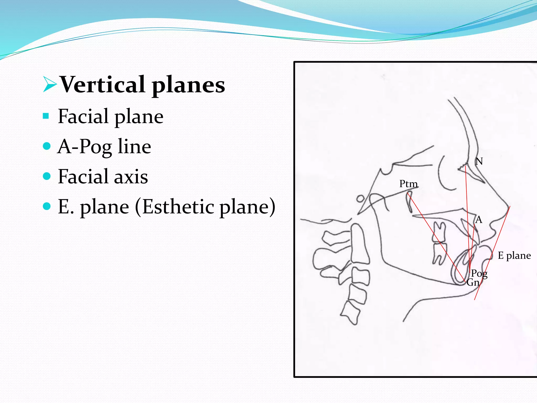Cephalometrics (hard and soft tissue ) - in detail | PPTX