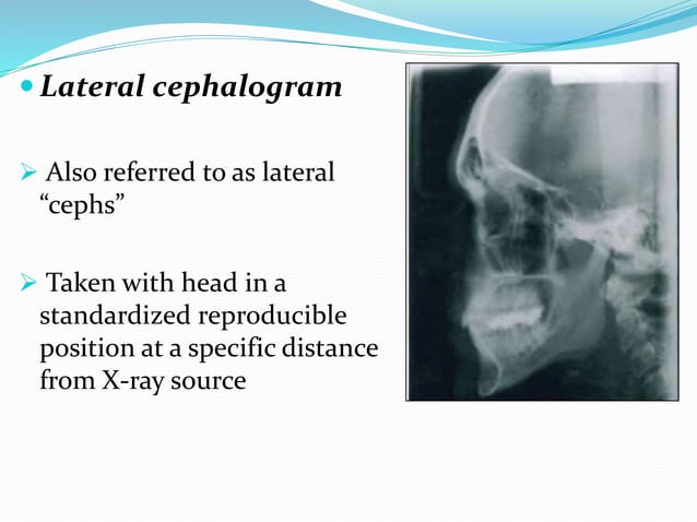 Cephalometrics (hard and soft tissue ) - in detail | PPTX