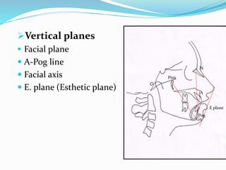 Cephalometrics (hard and soft tissue ) - in detail | PPTX