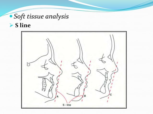 Cephalometrics (hard and soft tissue ) - in detail | PPTX