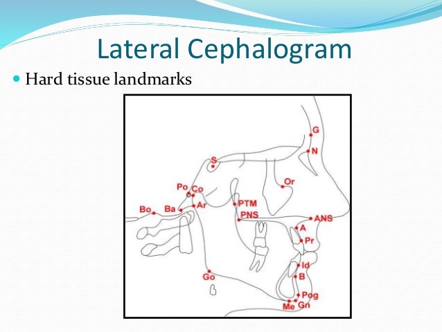 Cephalometrics (hard and soft tissue ) - in detail