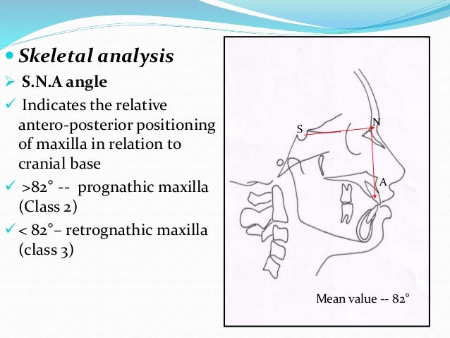 Cephalometrics (hard and soft tissue ) - in detail