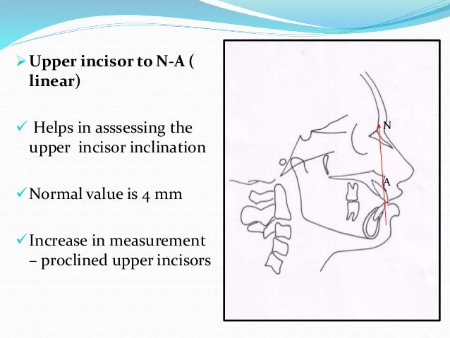 Cephalometrics (hard and soft tissue ) - in detail