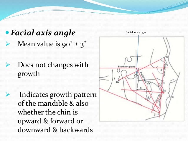 Cephalometrics (hard and soft tissue ) - in detail