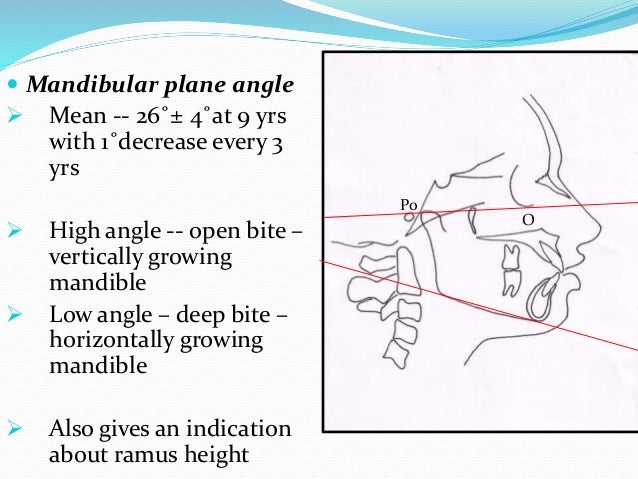 Cephalometrics (hard and soft tissue ) - in detail