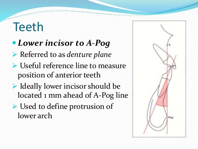Cephalometrics (hard and soft tissue ) - in detail