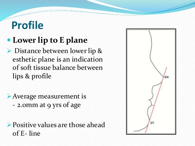 Cephalometrics (hard and soft tissue ) - in detail