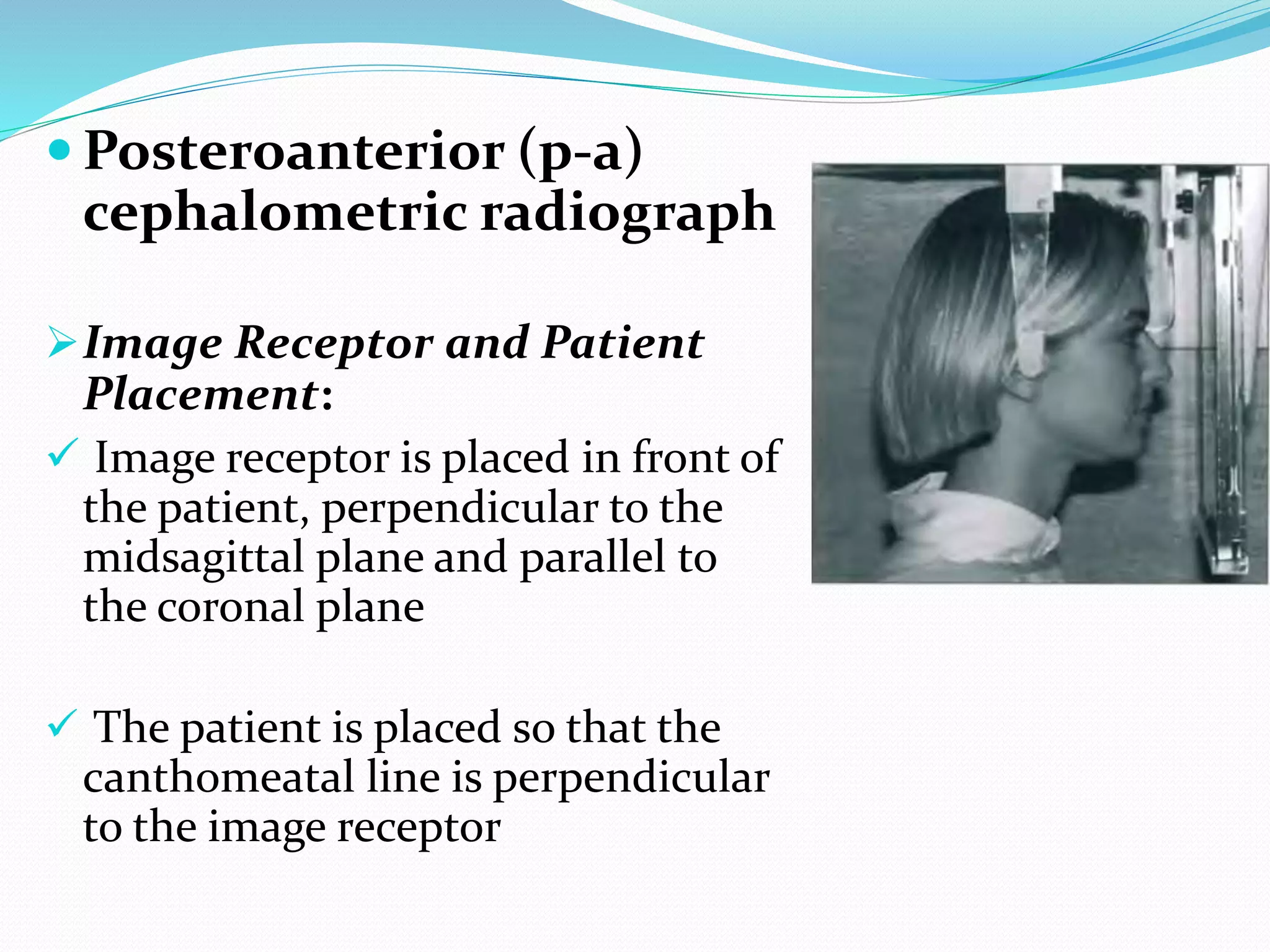 Cephalometrics | PPTX