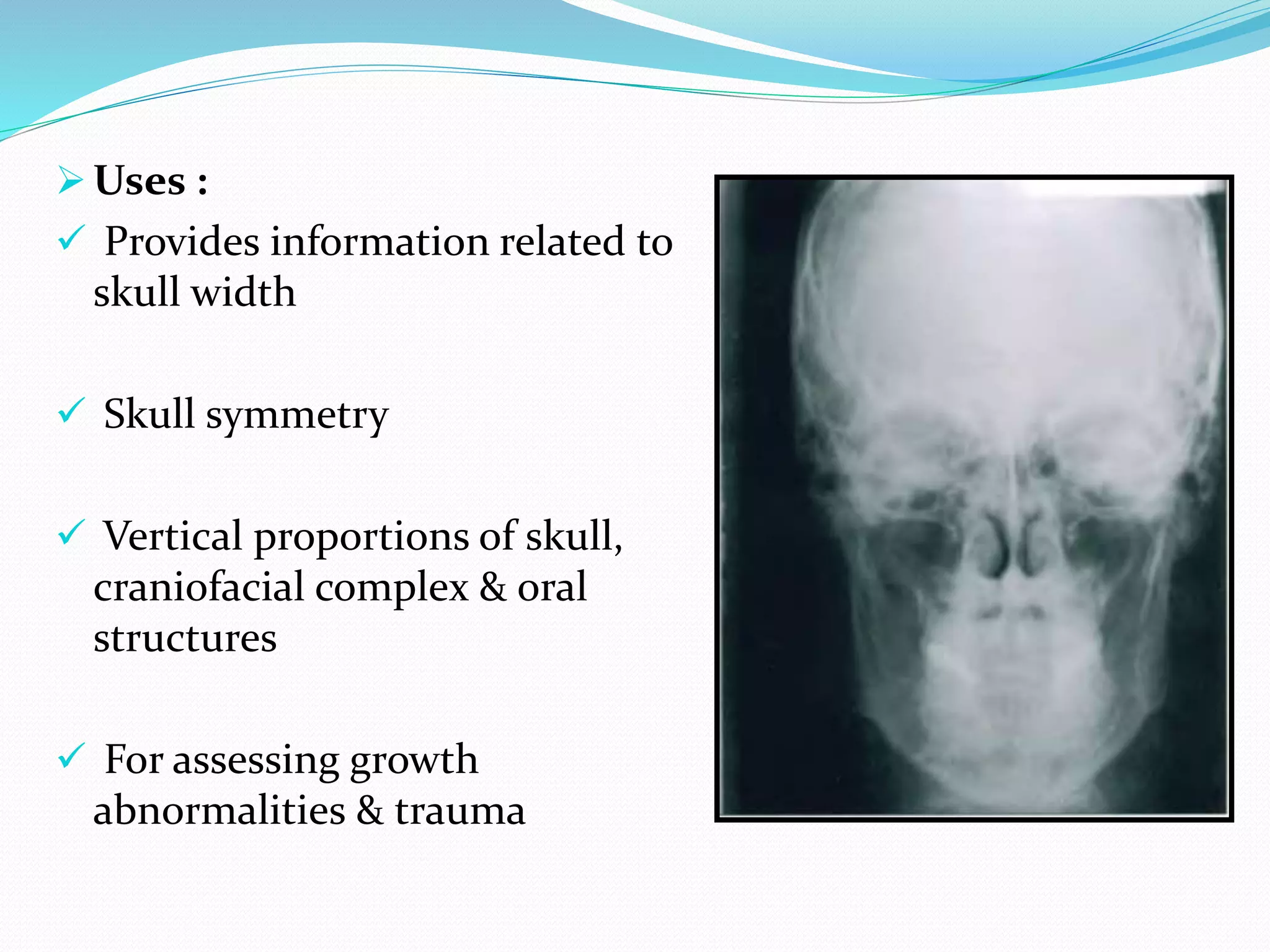 Cephalometrics | PPTX