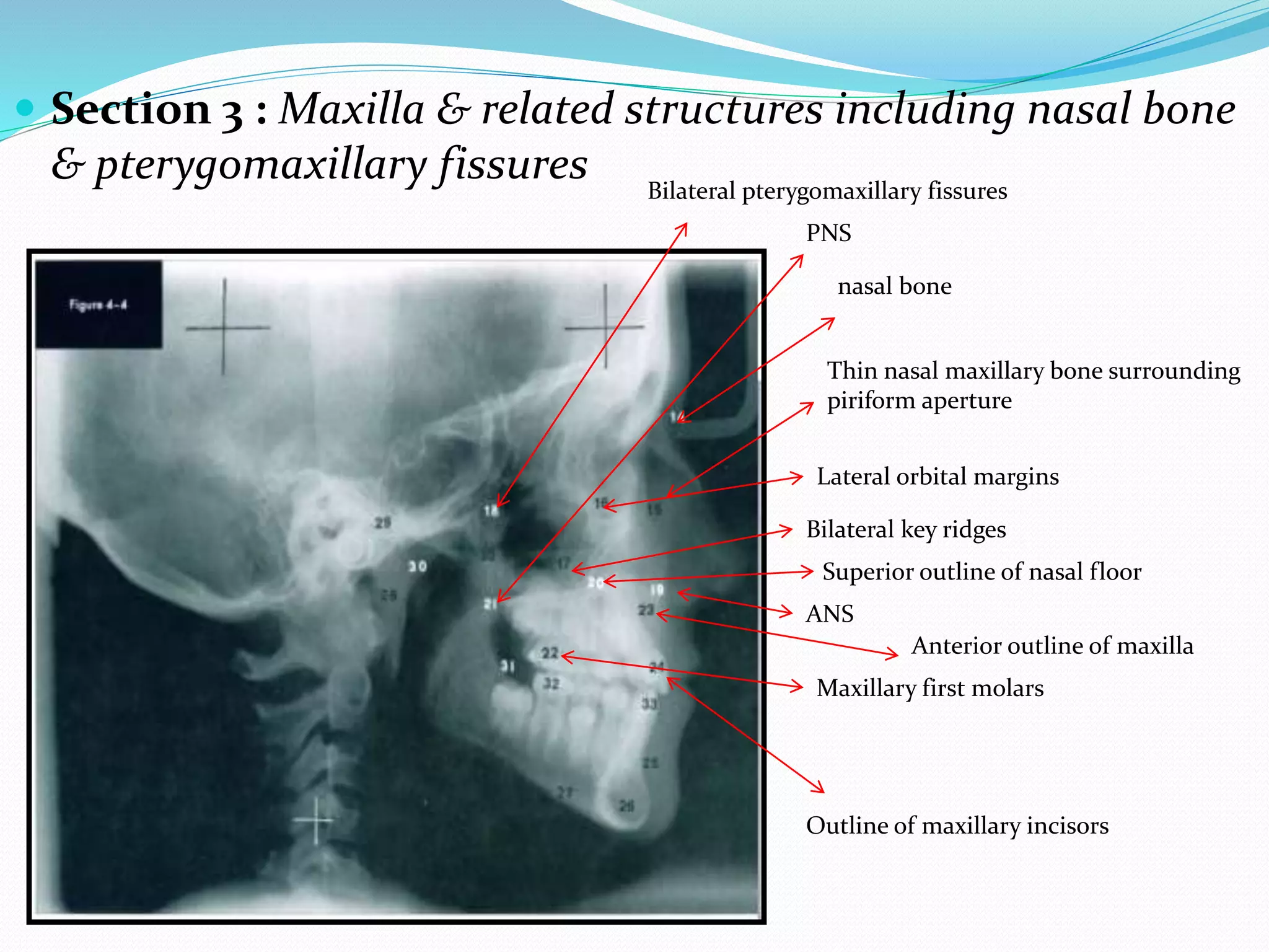 Cephalometrics | PPTX