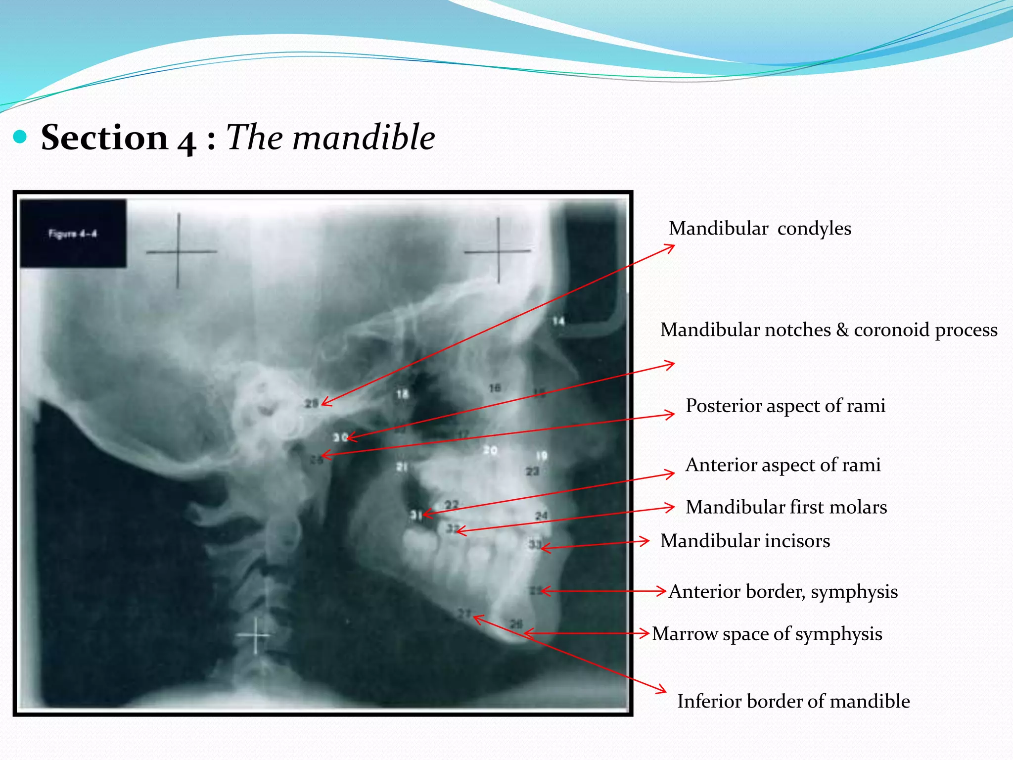 Cephalometrics | PPTX