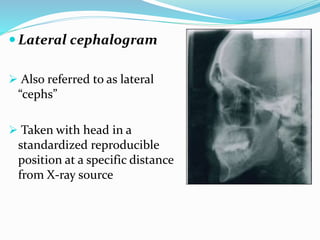 Cephalometrics | PPTX