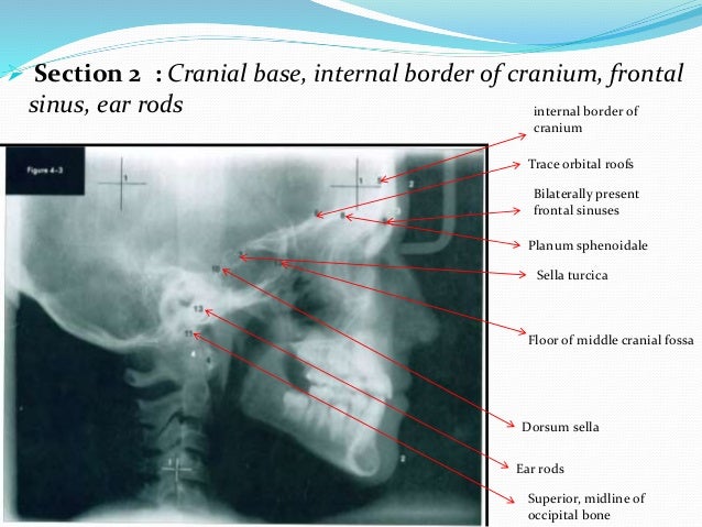 Cephalometrics