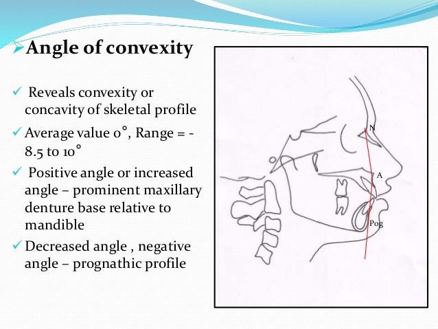 Cephalometrics