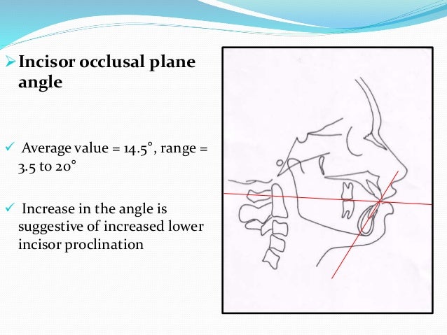 Cephalometrics