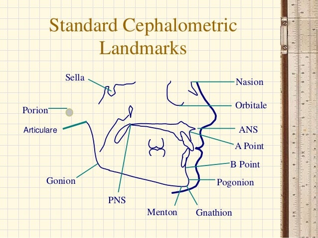 Cephalometrics