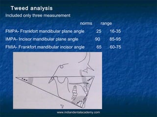Cephalometrics | PPT