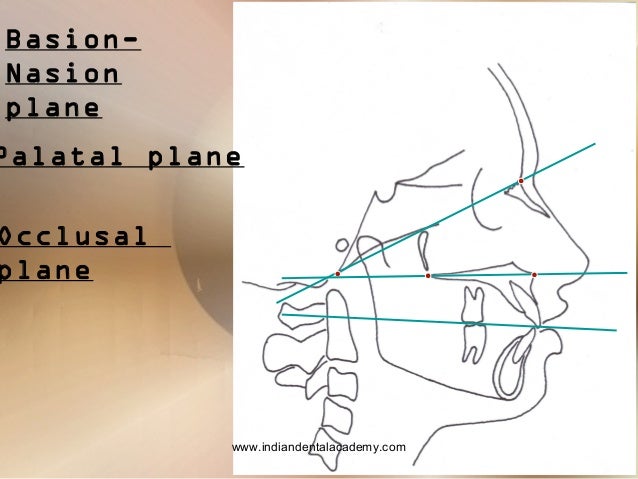 Cephalometrics