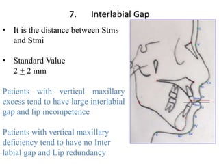 Cephalometrics EVALUATION AND INTERPRETATION | PPTX