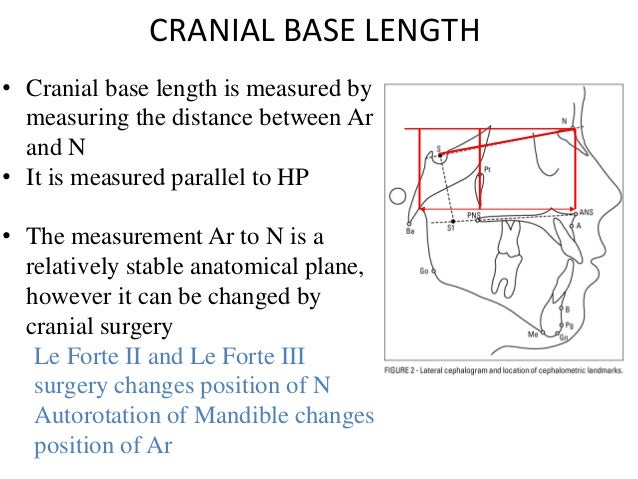 Cephalometrics EVALUATION AND INTERPRETATION