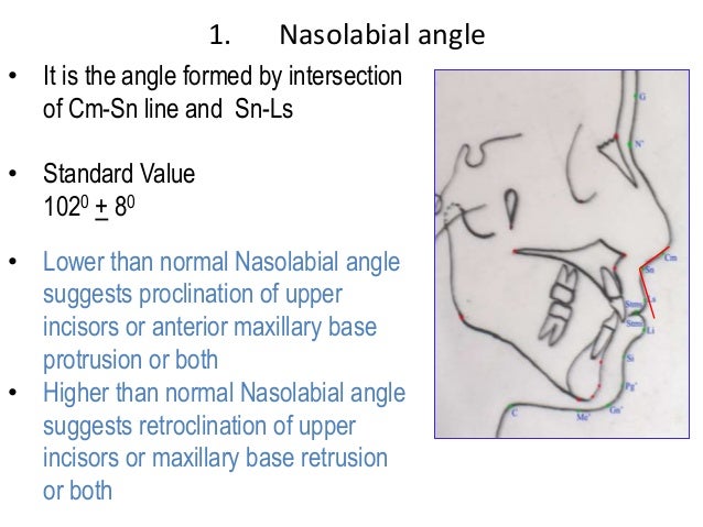 Cephalometrics EVALUATION AND INTERPRETATION
