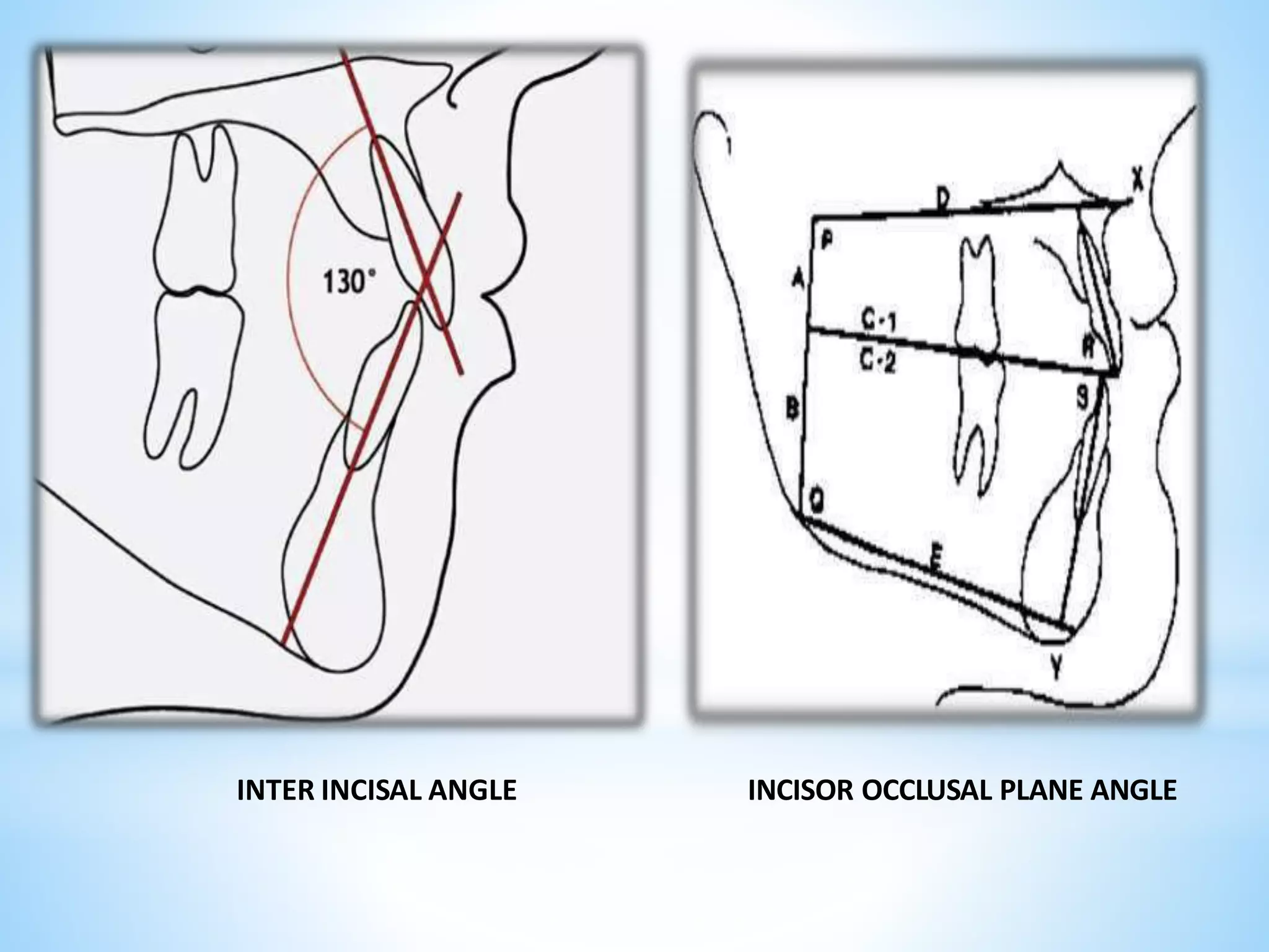 Cephalometrics | PPTX